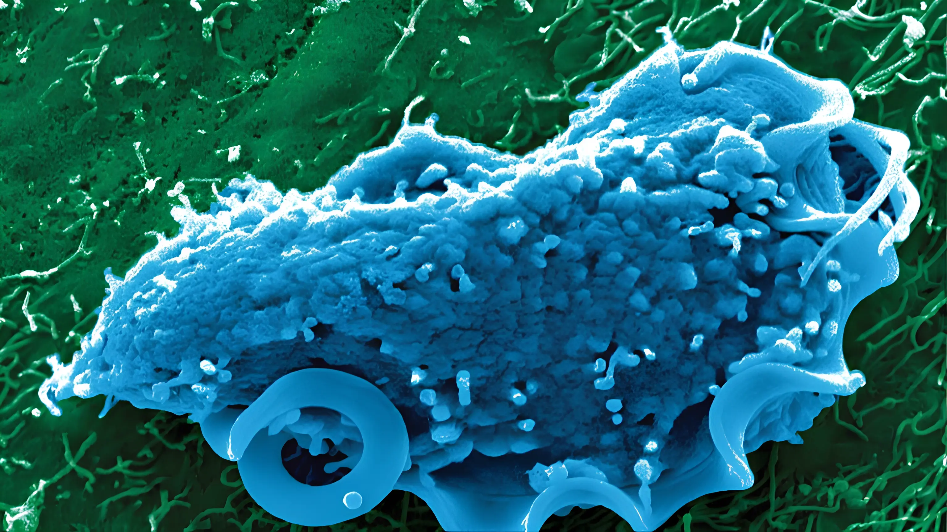 The Surprising Complexity of Strange Gut Microorganisms