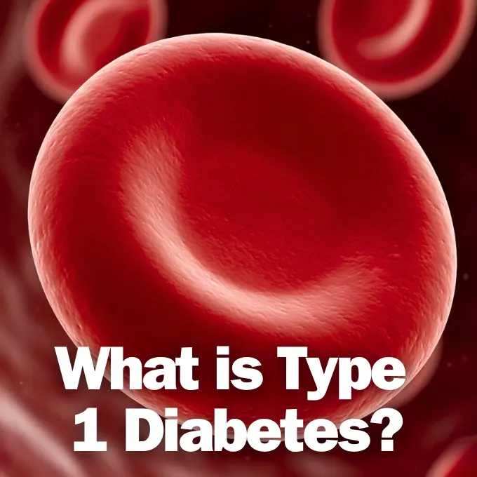 Type 1 Diabetes: A Guide to Its Causes, Symptoms and Care